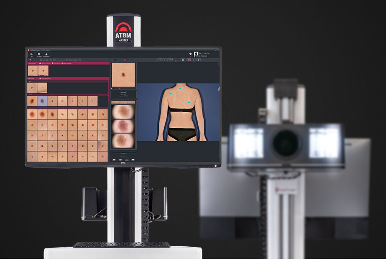 Nous disposons du Fotofinder ATBM Master avec intelligence artificielle (IA) - Dr Cerottini et ...